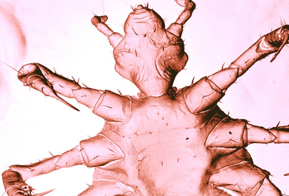 Trench Fever Appears In Colorado, How It Spreads Via Human Body Lice