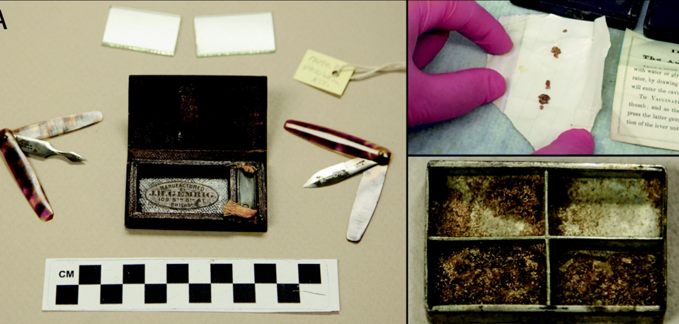 Scientists Sequence DNA From Civil War Era Smallpox Vaccines