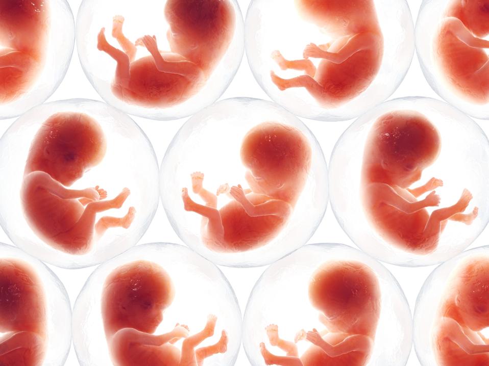 Here’s How AI Is Helping Make Babies By Revolutionizing IVF