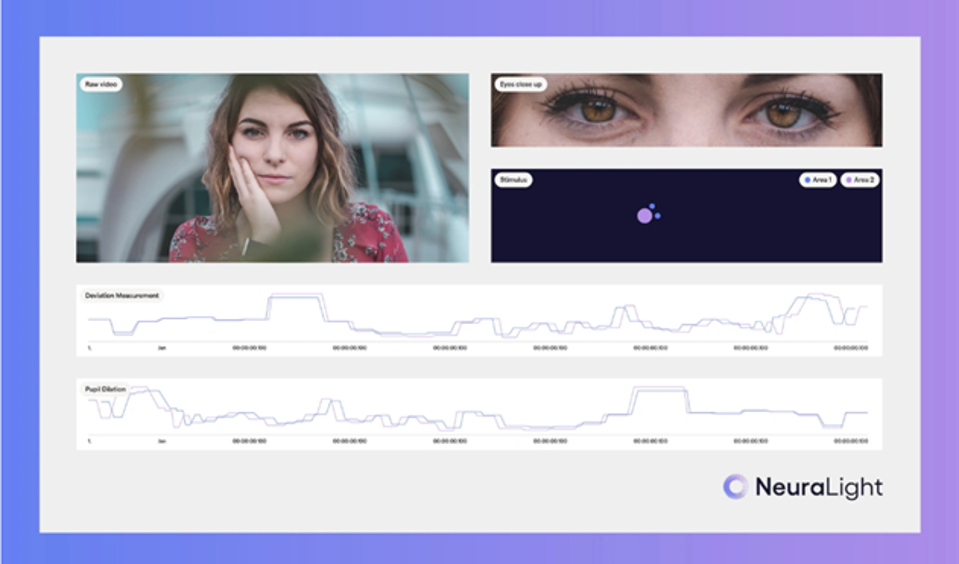 How AI Can Look Into Your Eyes And Diagnose A Devastating Brain Disease