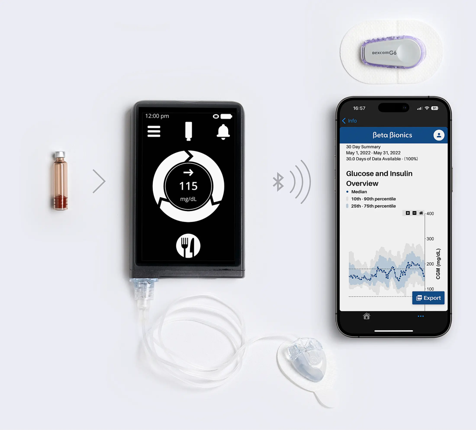 An Automated Solution: Simplifying Diabetes Control With The iLet ...