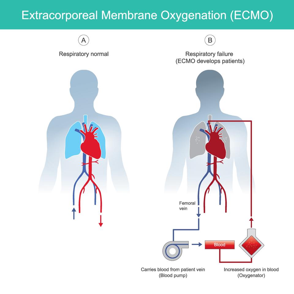 A Celebration Of Dr. Robert Bartlett, The ‘Father Of ECMO’
