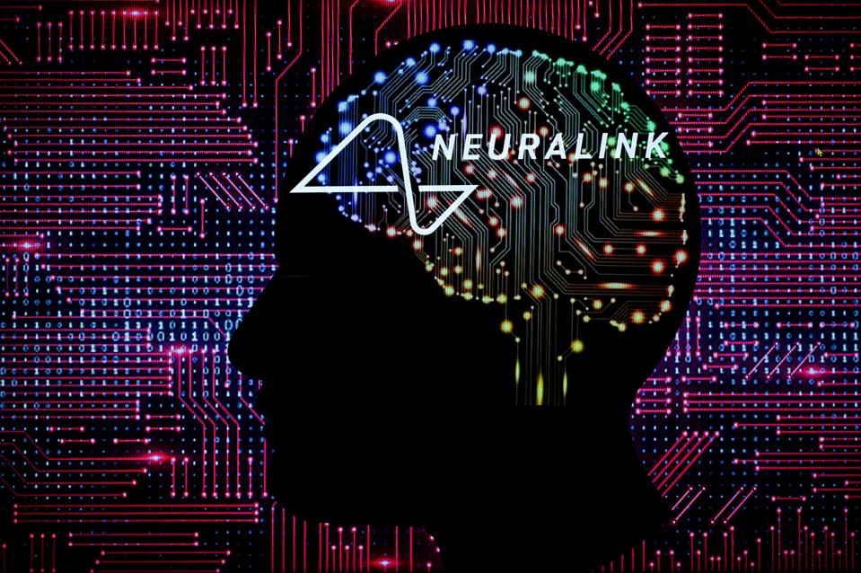 Human Trials For Elon Musk's Neuralink Offer New Hope,Neurologist Says