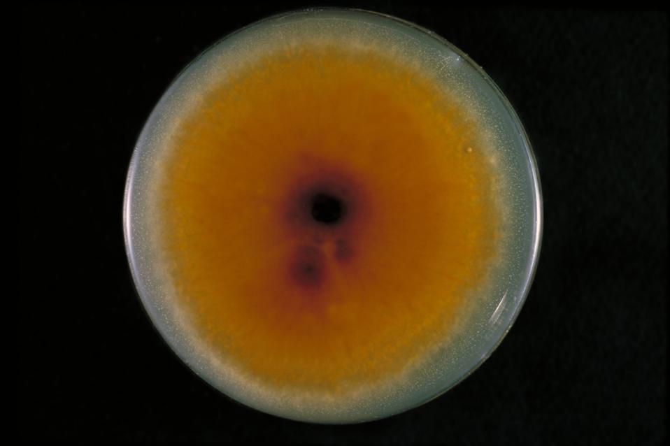 Rare Fungal Sexually Transmitted Infection Appears In America For First ...