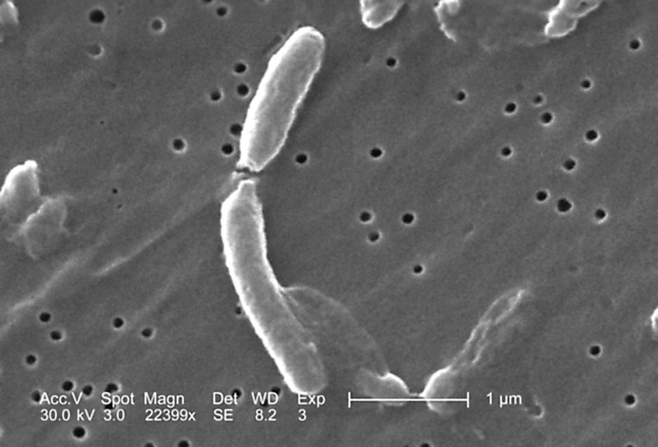 Study: Climate Change Could Trigger The Spread Of Novel Cholera Strains