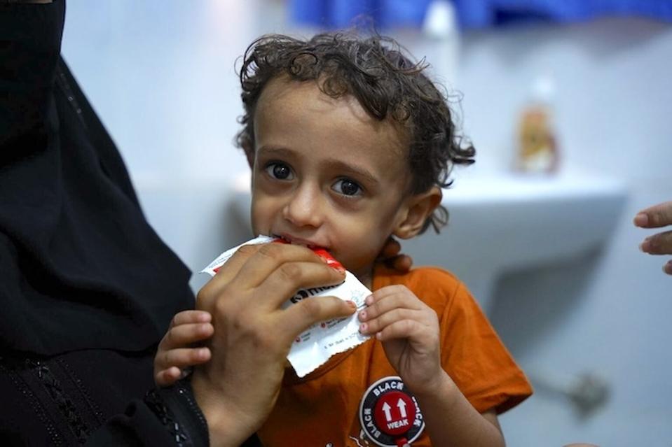 Acute Malnutrition Surges In Yemen