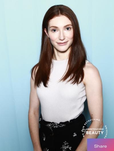 Botox Competitor Jeuveau Launches A $49-A-Month Membership