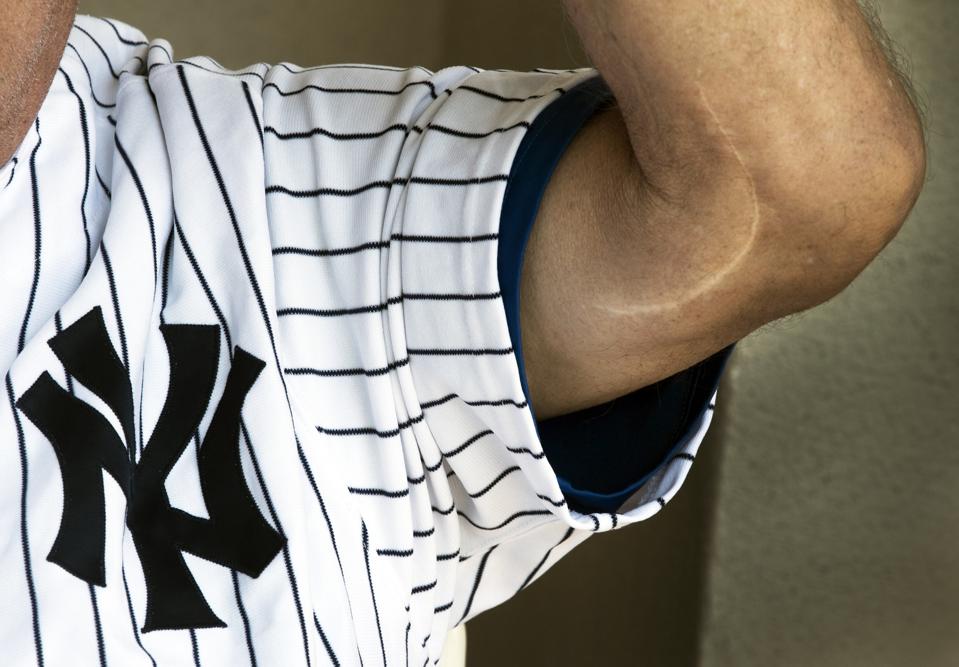 Pitcher Injuries Crisis Extends Well Beyond Major League Baseball