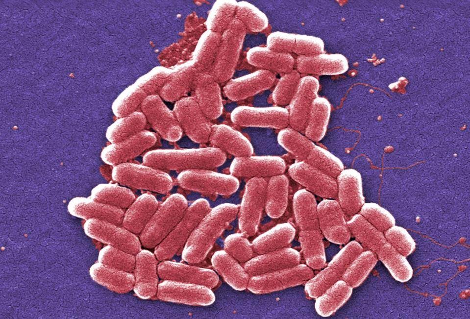 Scary Superbug Reaching U.S. Means That We Desperately Need New Antibiotics