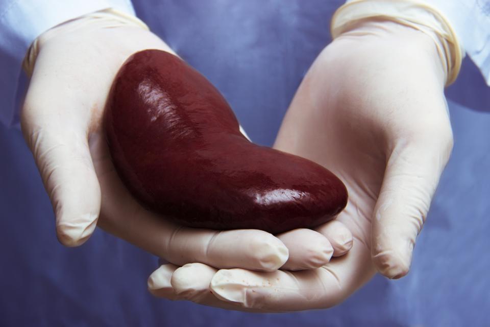How To Detect Kidney Organ Transplant Rejections CRISPR Pee And A How To Detect Kidney Organ Transplant Rejections CRISPR Pee And A